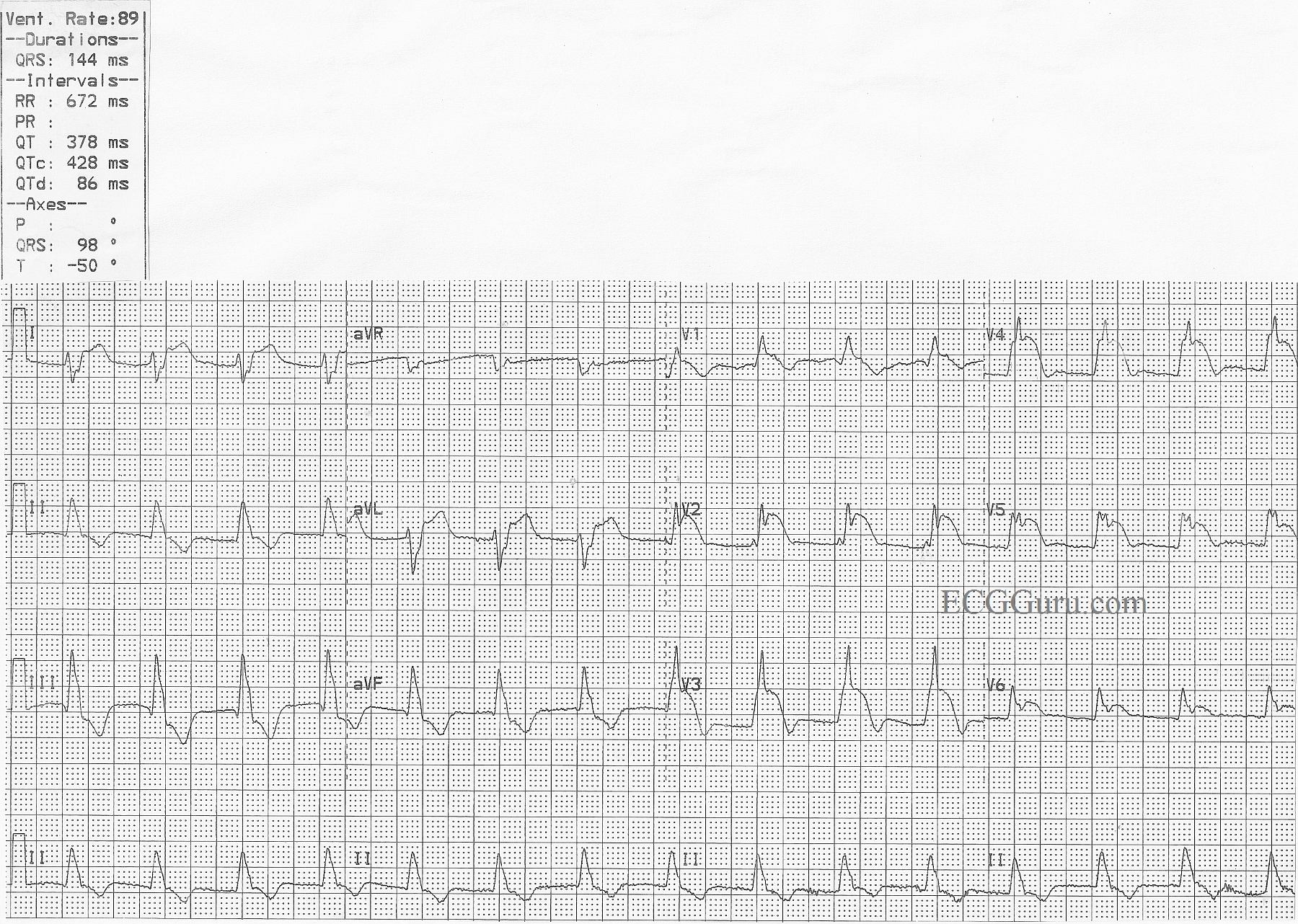 LPFB | ECG Guru - Instructor Resources