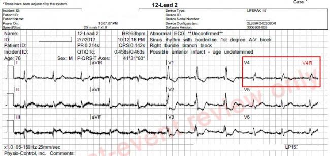 Artifact | ECG Guru - Instructor Resources